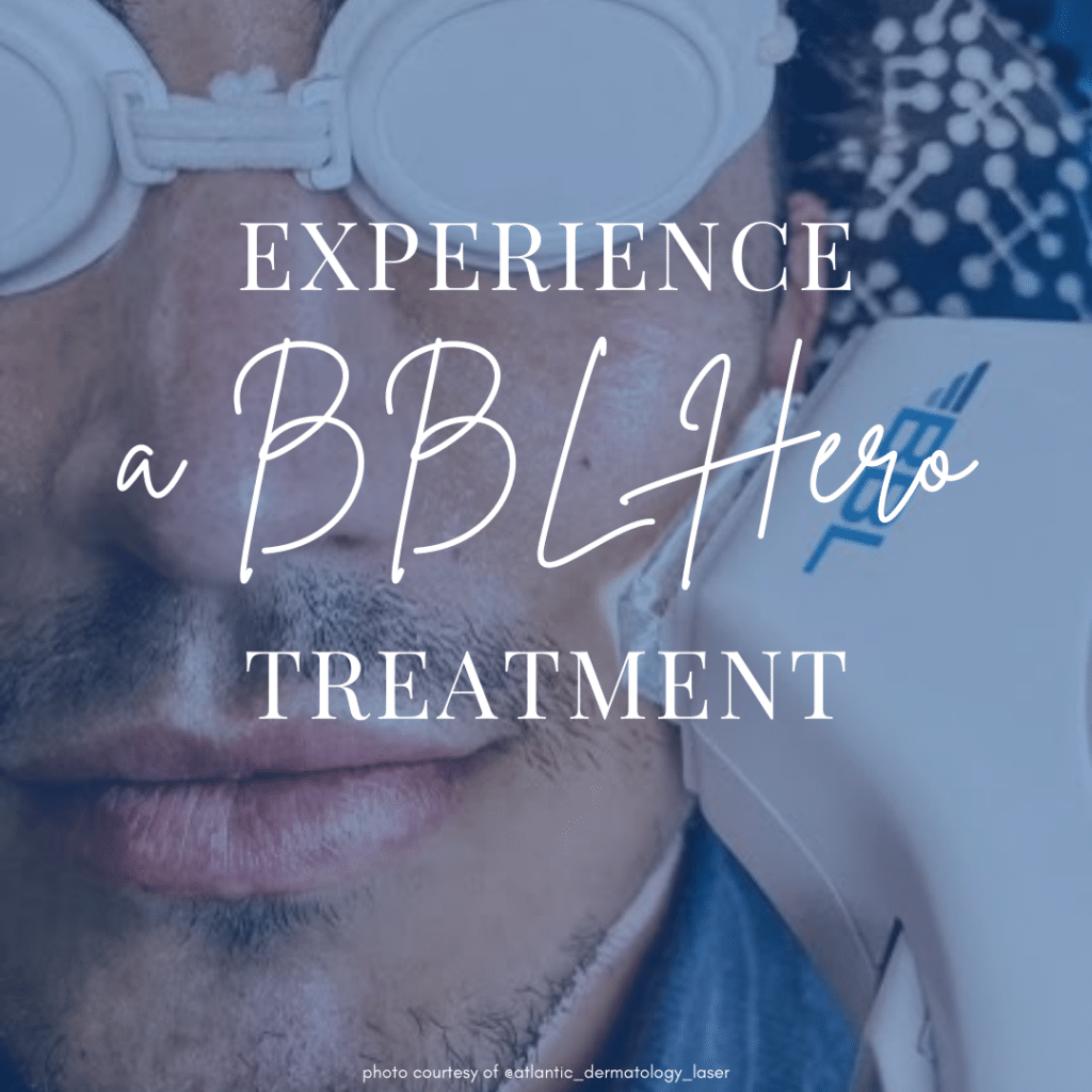 BBL® HERO™ Laser Charleston WV – Broadband Light Therapy
